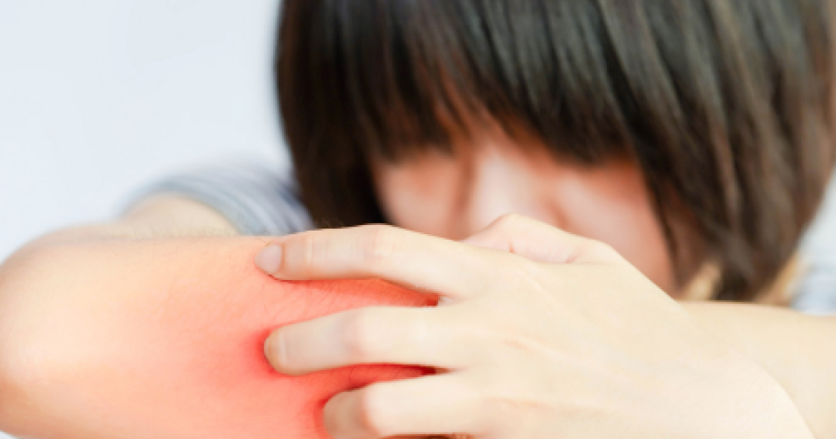 Comprendre le prurit et le prurigo | Dermato-INFO